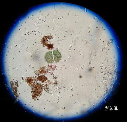 Chroococcus subnudus · iNaturalist United Kingdom
