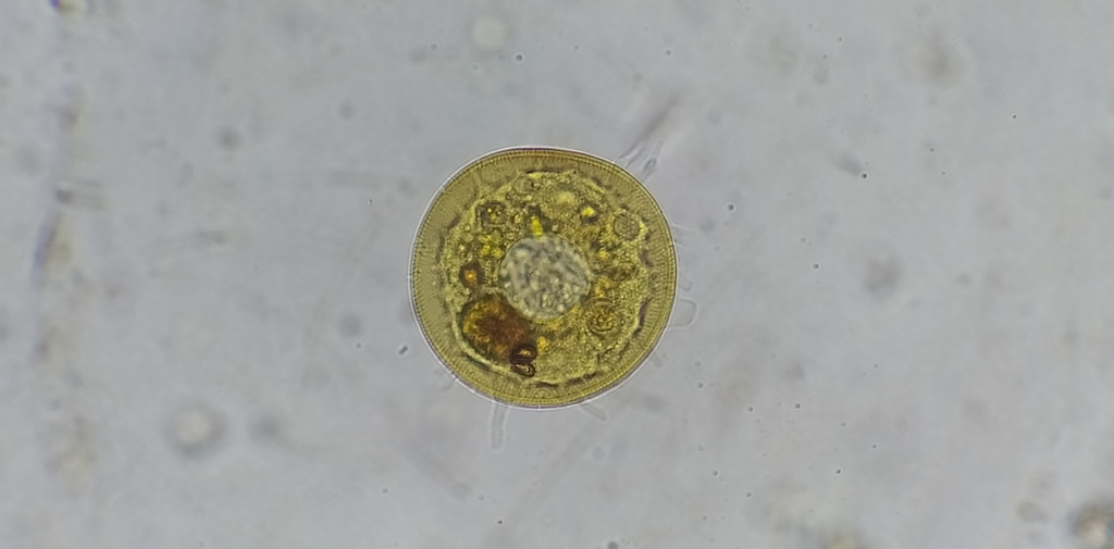 Arcella from Río de Oro, Cesar, Colombia on May 7, 2021 at 10:04 PM by ...