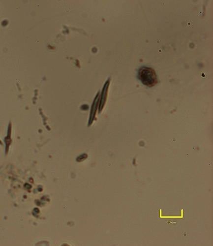 Family Elakatotrichaceae · iNaturalist