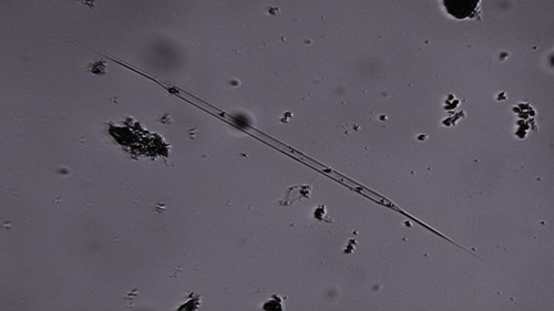 (Urosolenia)