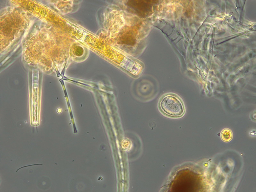 Subphylum Endomyxa · iNaturalist