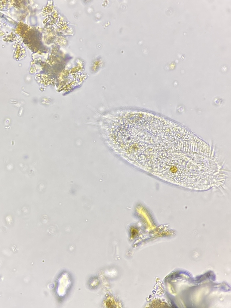 Stylonychia Microscopy Stylonychia Ciliophora, Under The Microscope