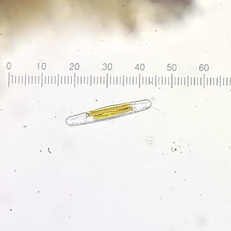 Pinnularia from Halifax, NS B3H 4H6, Canada on May 02, 2022 by Isabelle ...