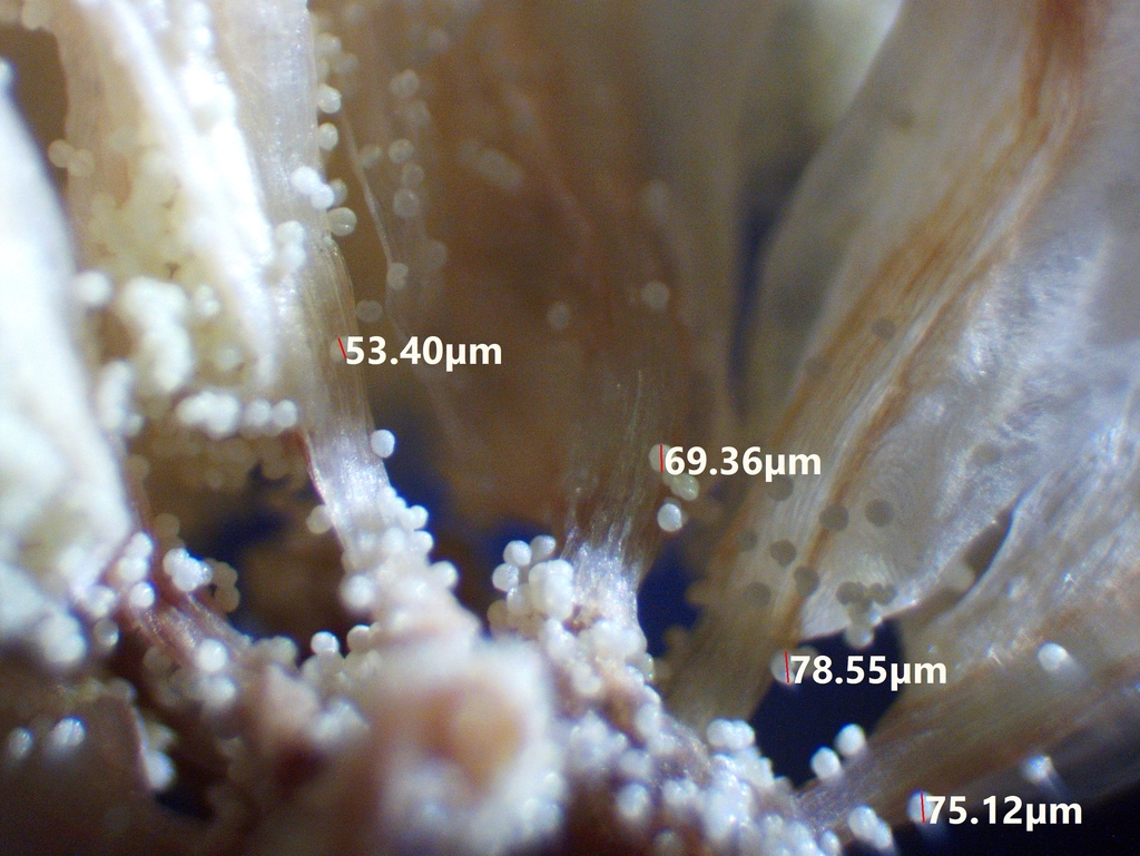 spruces in May 2022 by Kate Calderwood. Pollen cones were dropping so I ...