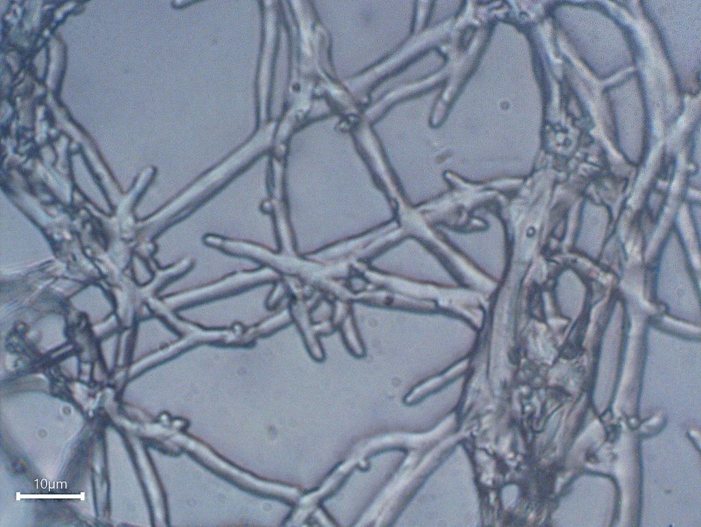 Penicillium in June 2022 by Kate Calderwood. Another native oyster ...