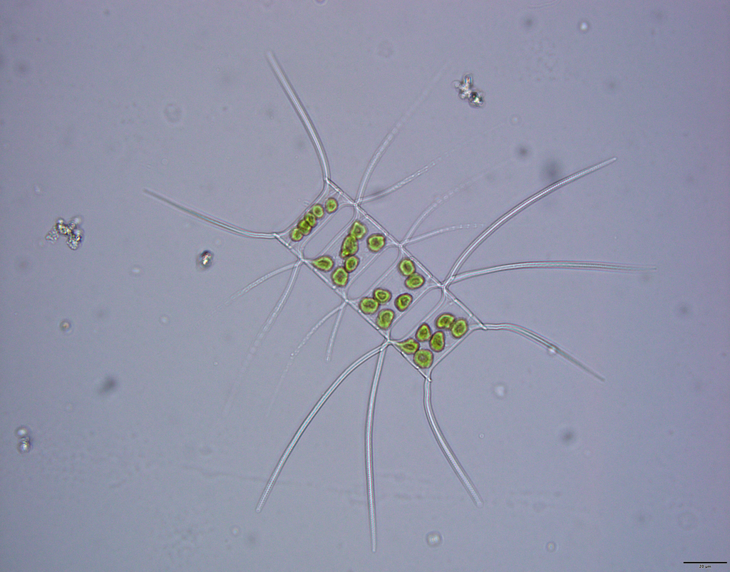 Bacteriastrum (Marine Phytoplankton of the Grand Strand Region of SC ...