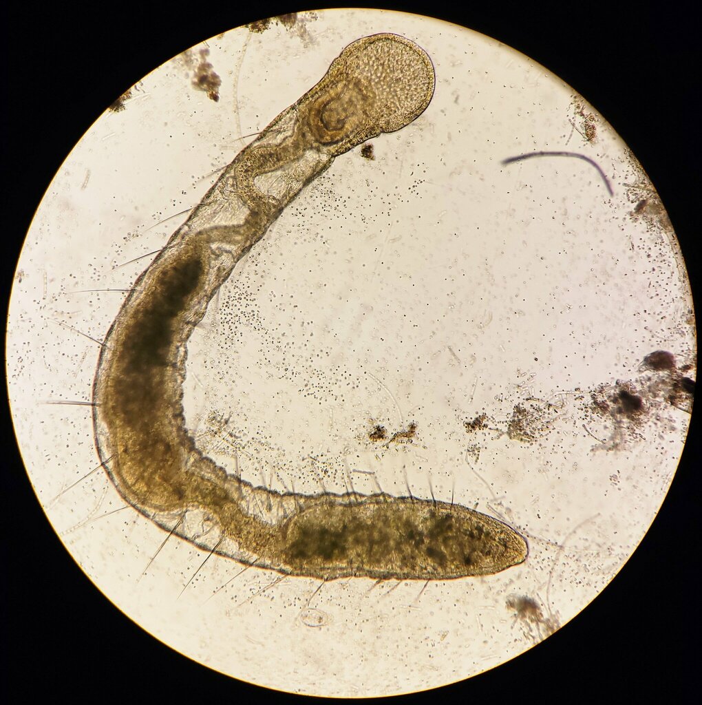 Aeolosoma Worm from Uberlândia, Minas Gerais, Brazil on August 03, 2022 ...