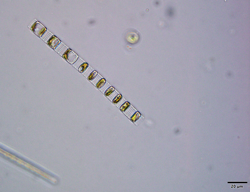 Skeletonema (Marine Phytoplankton of the Grand Strand Region of SC ...