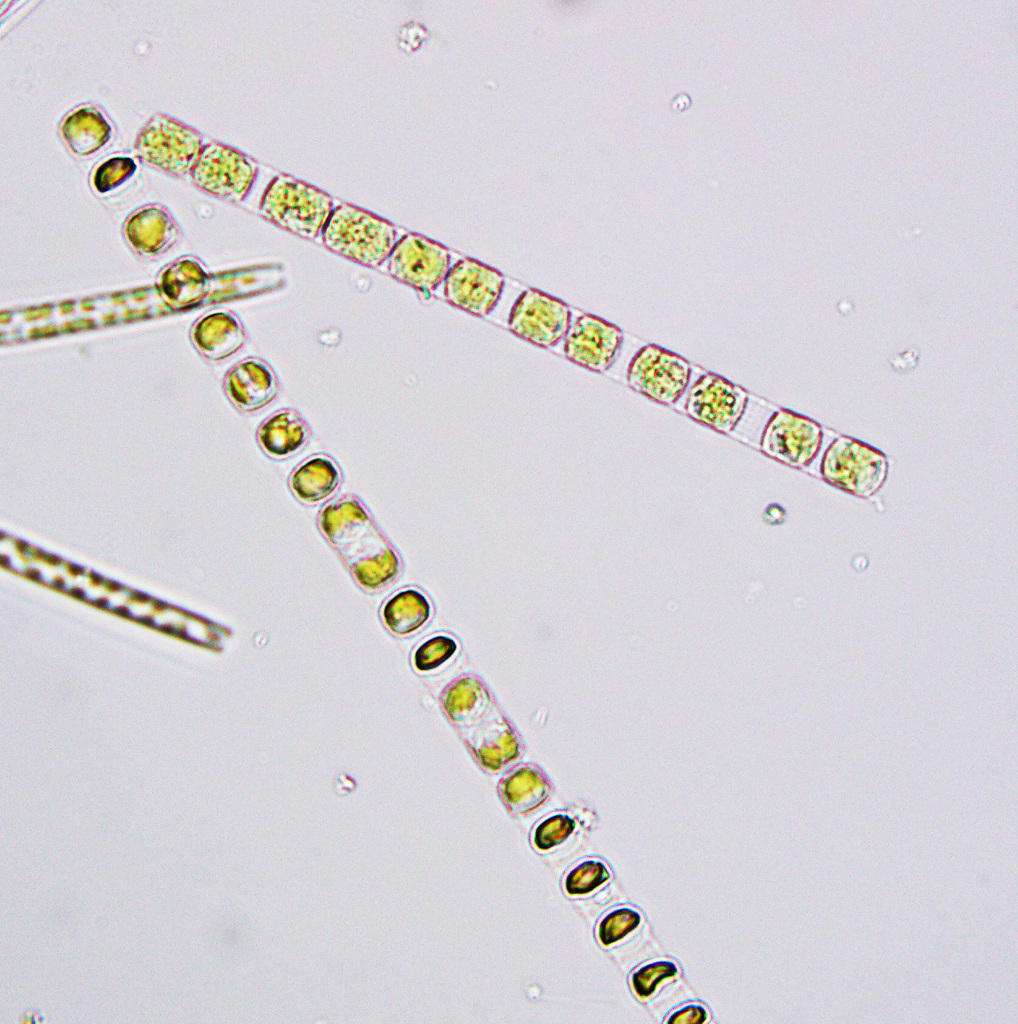 Skeletonema (Marine Phytoplankton of the Grand Strand Region of SC ...