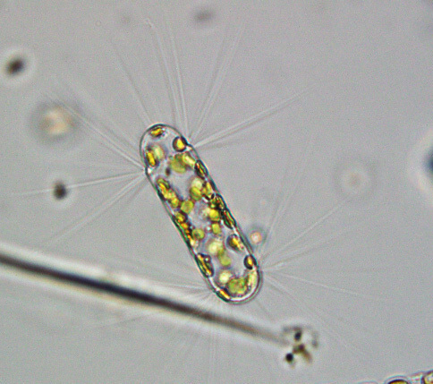 Corethron (Marine Phytoplankton of the Grand Strand Region of SC ...