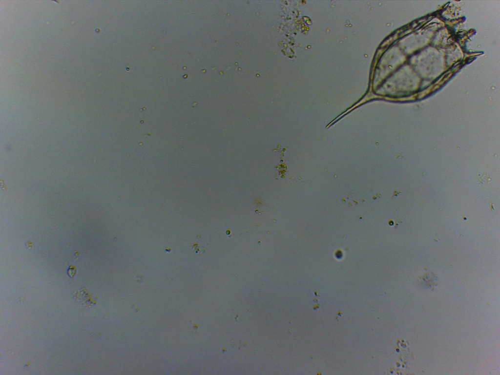 Keratella cochlearis from Northern, Moscow City, RU on September 25 ...
