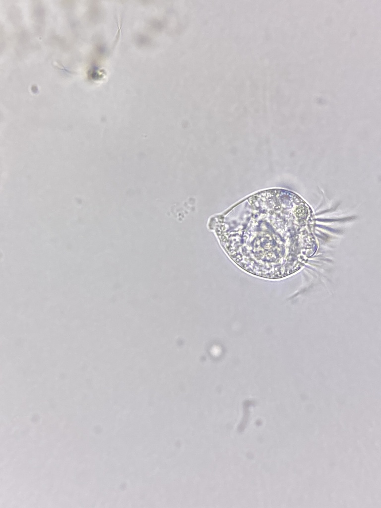 Strobilidium caudatum from Ibsen Dr, North Bethesda, MD, US on February ...