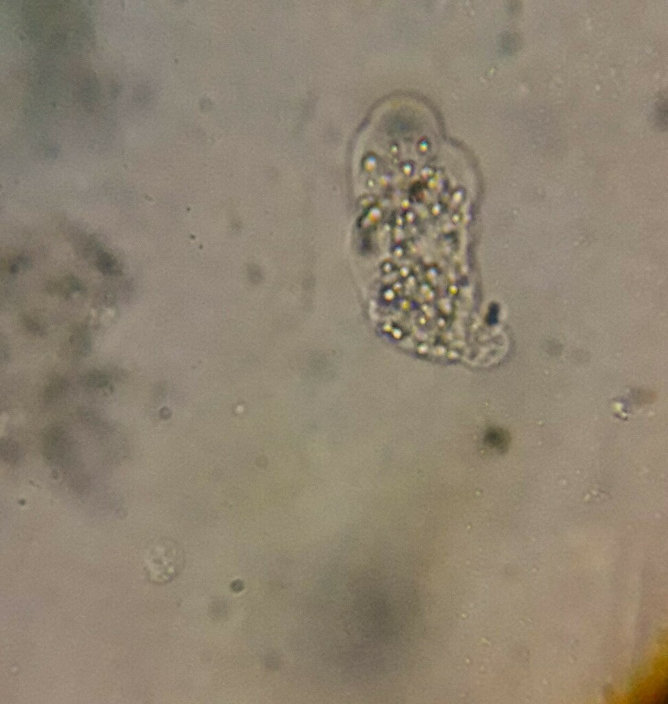 Amoebidae from Manuel Salazar S/N, Hacienda del Rosario, Prados del ...