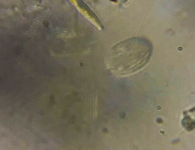 Ciliates from Manuel Salazar S/N, Hacienda del Rosario, Prados del ...