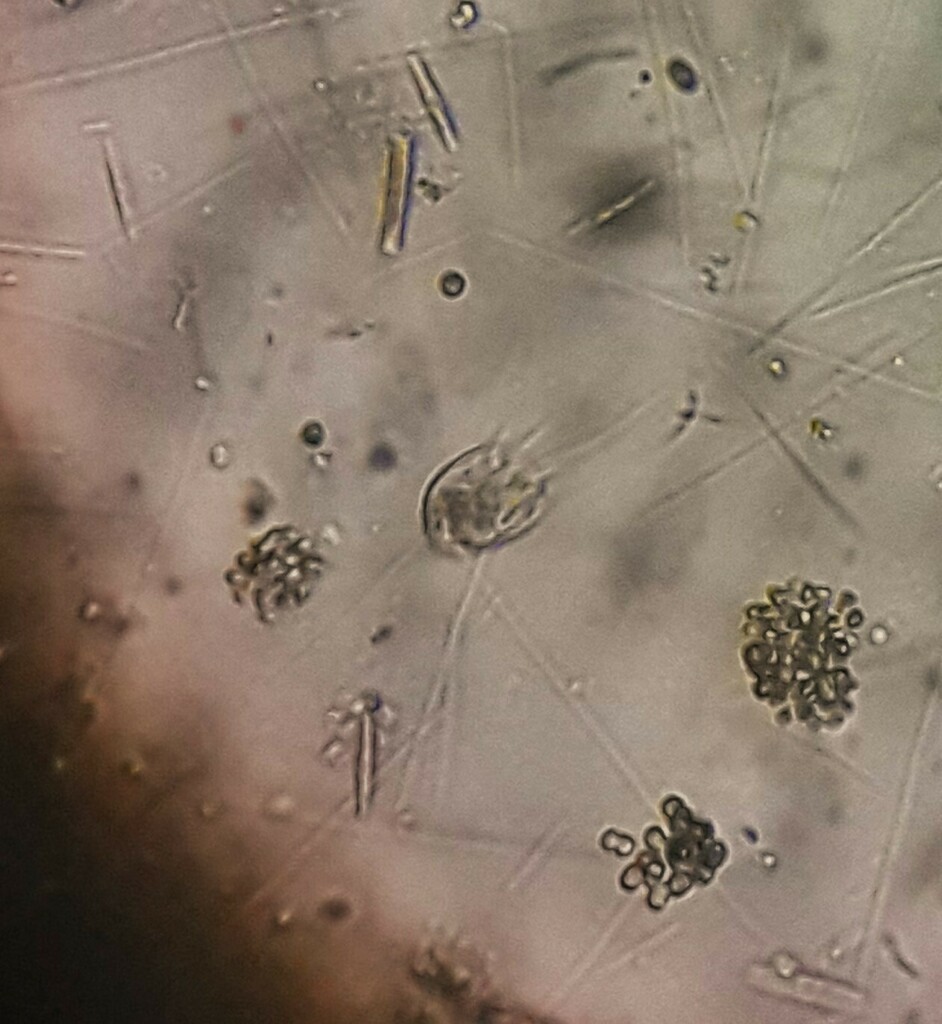 Aspidisca from Azcapotzalco, Mexico City, CDMX, Mexico on May 11, 2023 ...