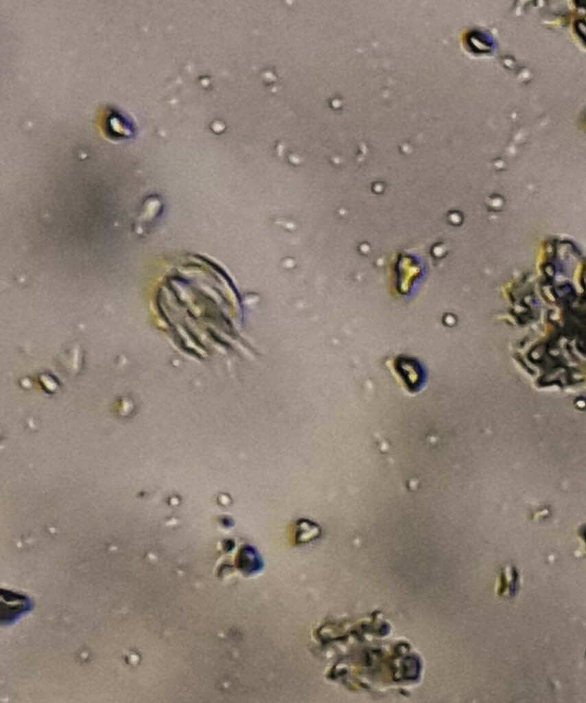 Aspidisca from Zumpango, State of Mexico, Mexico on May 14, 2023 at 05: ...