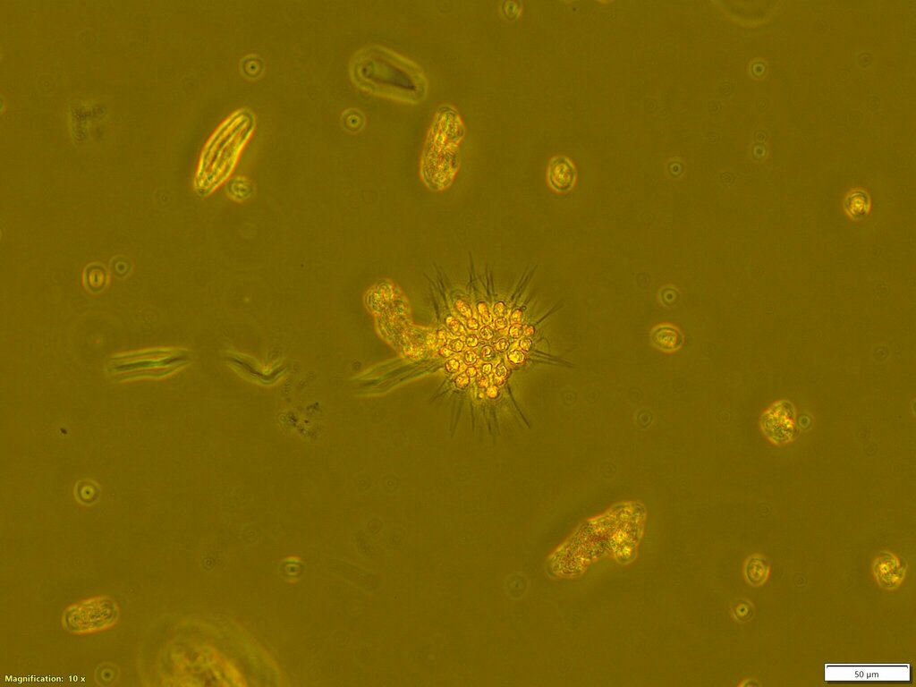 Chrysosphaerella from Thunder Bay District, ON, Canada on October 5 ...