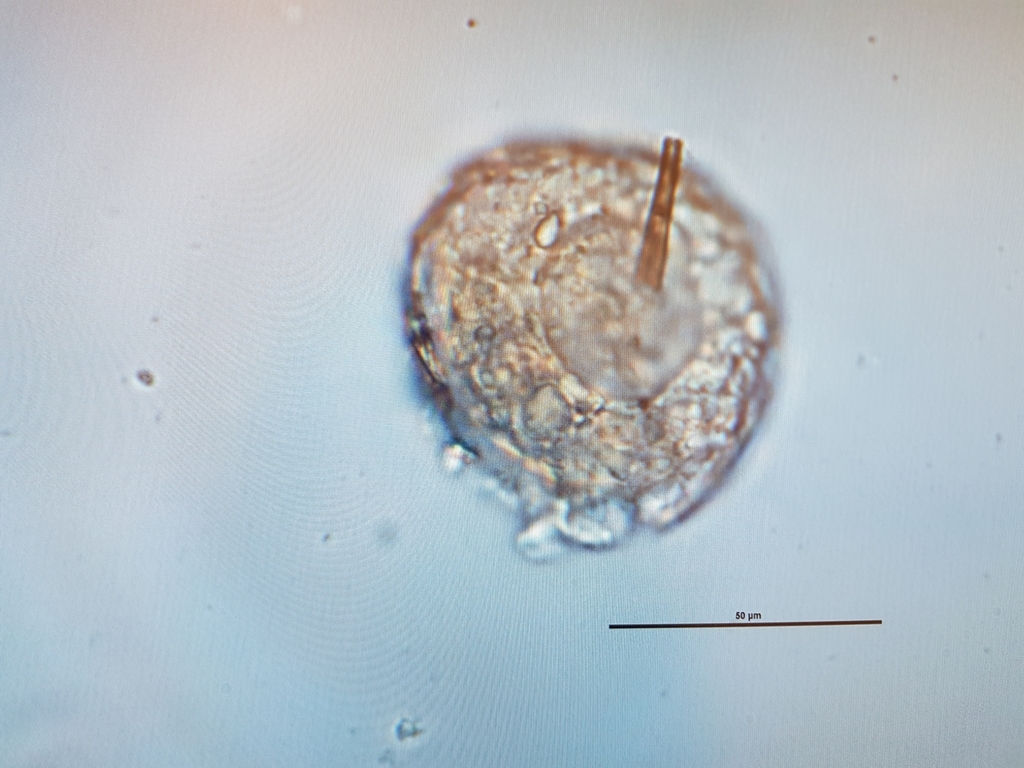 Cyclopyxis eurystoma from 280 Beach Rd, Burwood, Christchurch 8083, New ...
