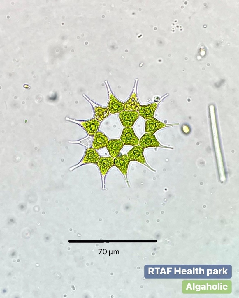 Monactinus simplex from สวนสุขภาพกองทัพอากาศ, กรุงเทพมหานคร ...