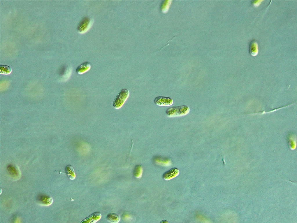 Mesotaenium from Cvikov, Česko on June 19, 2024 at 11:53 PM by Pavel ...