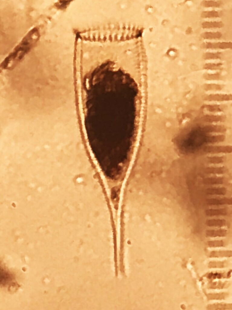 Parafavella denticulata from Krosno Odrzańskie County, Poland on August ...