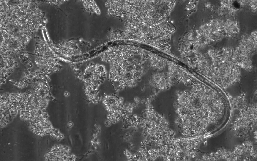 Human pinworm from Waterfront South, Camden, NJ 08104, USA on March 26 ...