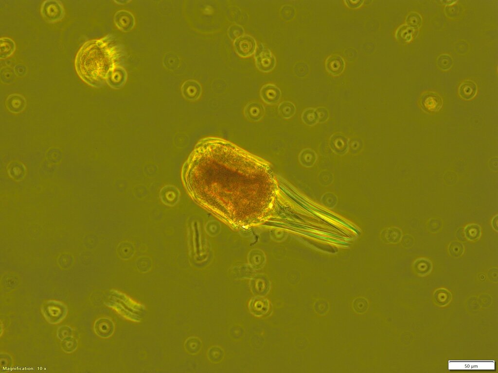 Polyarthra from Cochrane District, ON, Canada on December 31, 2024 at ...