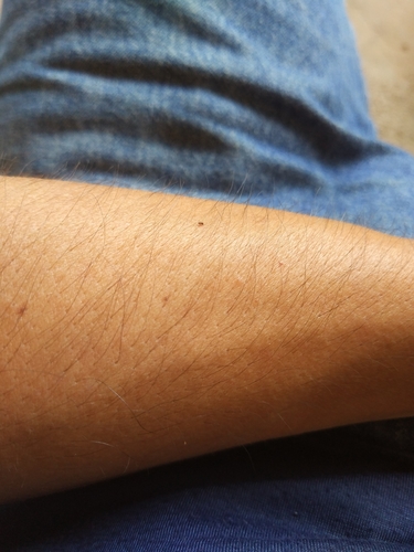 Chaquiste (Culicoides paraensis)