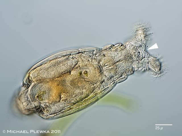 Philodina plena from 51503 Rösrath, Deutschland on January 2, 2011 by ...