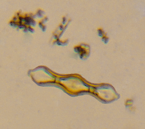 Variety Caloneis lewisii inflata · iNaturalist