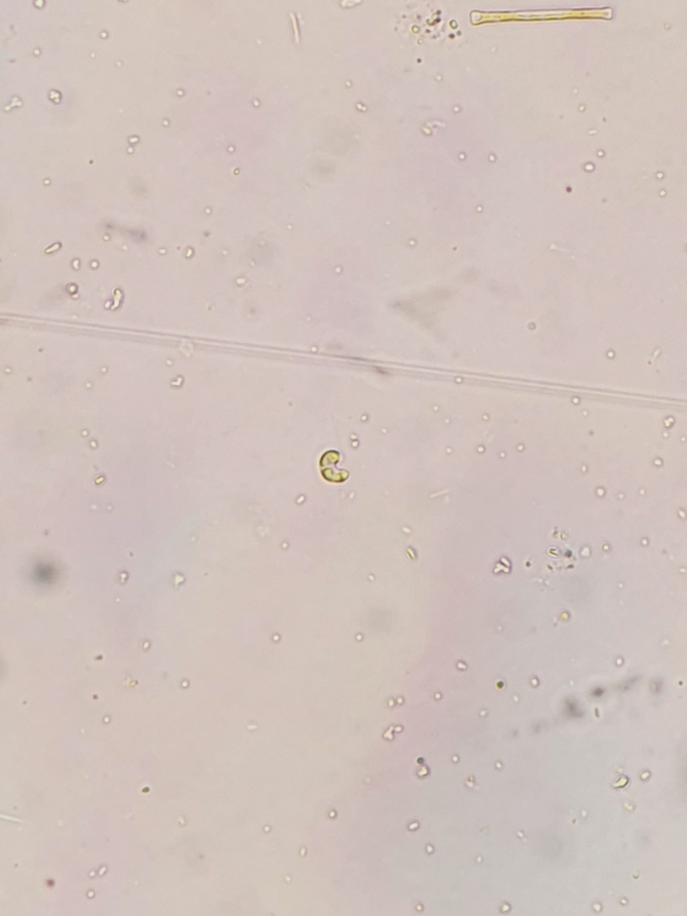 (Raphidocelis sigmoidea) - Botanical Realm