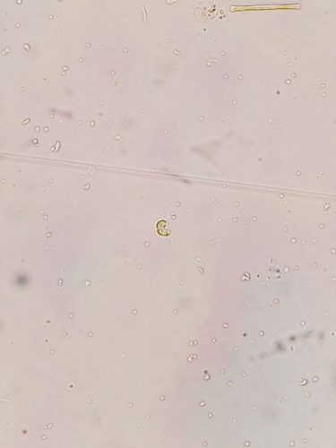 Raphidocelis sigmoidea · iNaturalist