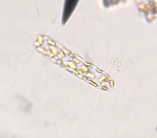 Corethron (Marine Phytoplankton of the Grand Strand Region of SC ...