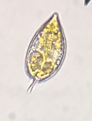 Prorocentrum (Marine Phytoplankton of the Grand Strand Region of SC ...