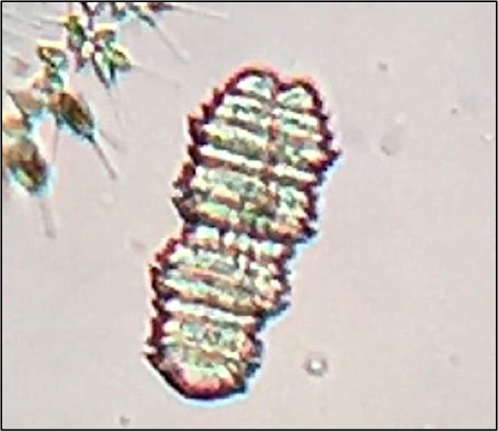 Polykrikos (Marine Phytoplankton of the Grand Strand Region of SC ...