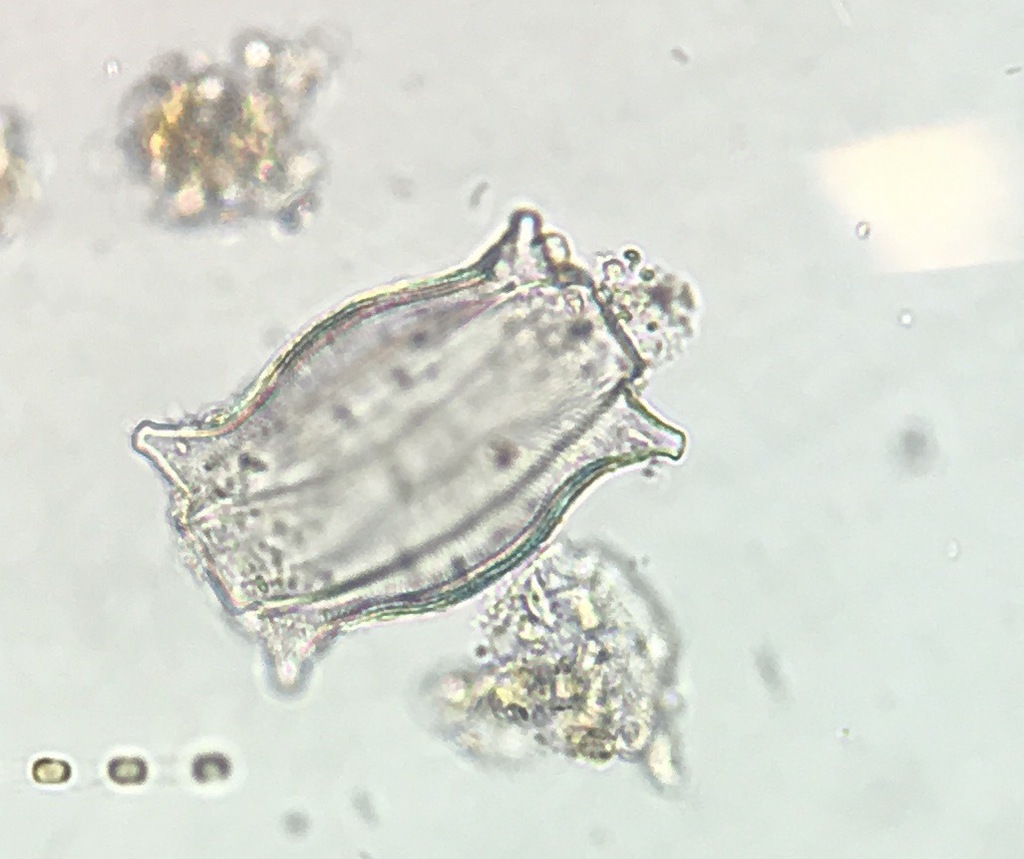 Biddulphia (Marine Phytoplankton of the Grand Strand Region of SC ...