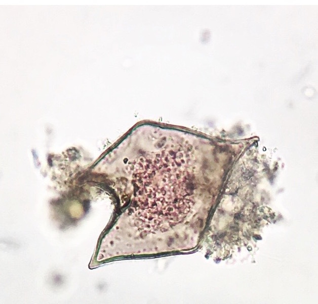 Protoperidinium (Marine Phytoplankton of the Grand Strand Region of SC ...