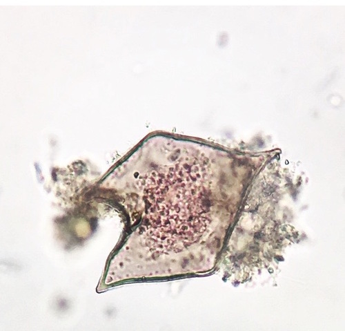 Protoperidinium (Marine Phytoplankton of the Grand Strand Region of SC ...