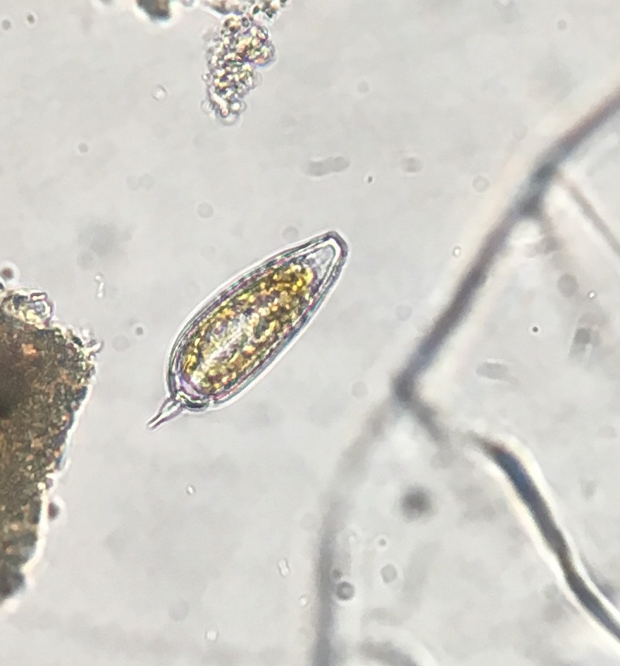 Prorocentrum (Marine Phytoplankton of the Grand Strand Region of SC ...