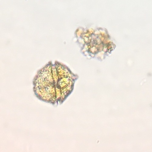 Gonyaulax (Marine Phytoplankton of the Grand Strand Region of SC ...